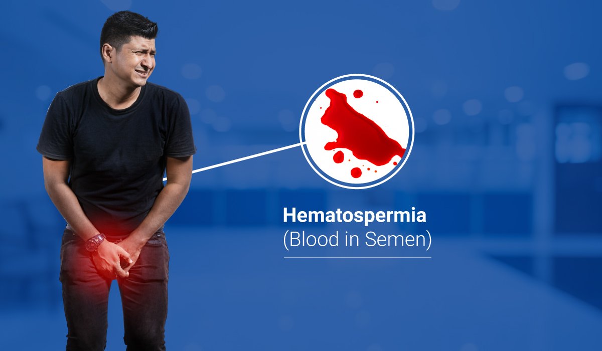 Hematospermia (Blood in Semen): When Should You Be Concerned? - Dr ...